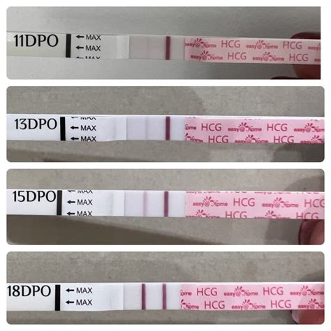 Line Progression Mumsnet