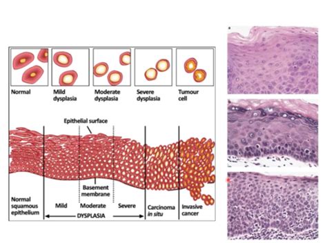 How Do Tumours Develop Flashcards Quizlet