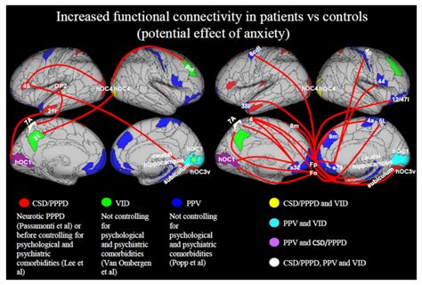 Brain Correlates Of Persistent Postural Perceptual Dizziness A Review