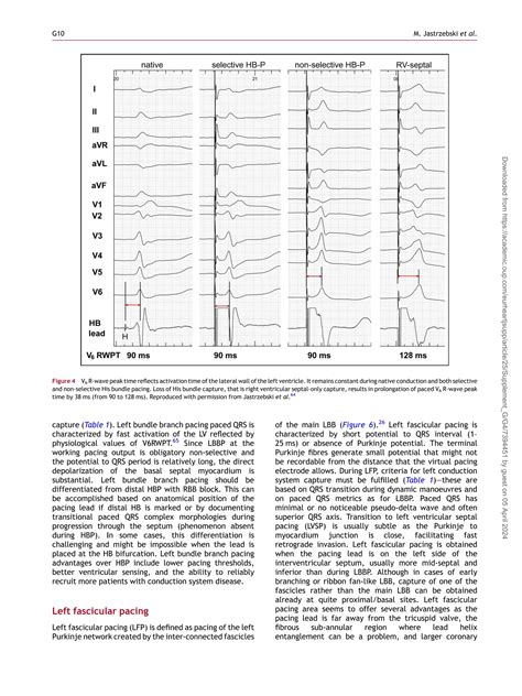 Suad114pdf Pacing Conduction System Pacing Pdf