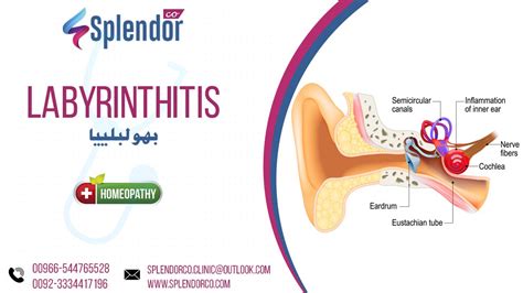 Homeopathic Medicine For Labyrinthitis