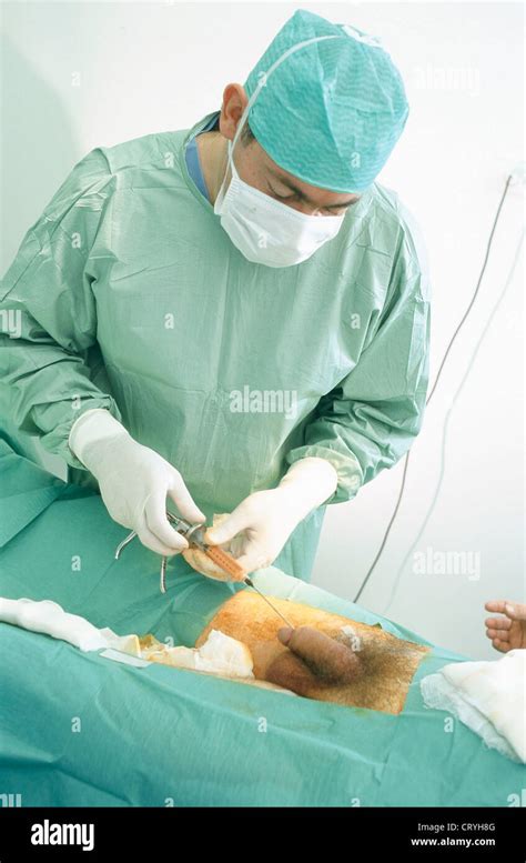 Operation Penis Usa Pénoplastie Prix Précautions à Prendre Avant