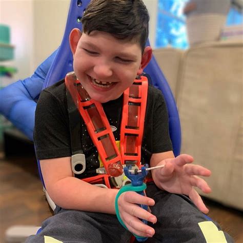 Best Adl Universal Cuffs Functionalhand® Vs Traditional Cuff Utensil Holders