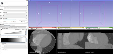 Volume Rendering Does Not Appear In D View Support D Slicer Community