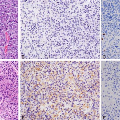 A Histopathology Findings Of Tissue Sampled During The First Download Scientific Diagram