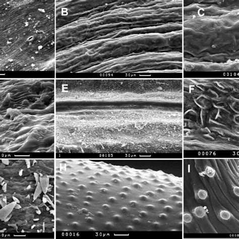 Surface Patterns When Cell Borders Indistinct A Cenolophium Download Scientific Diagram