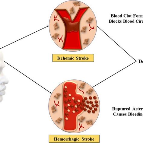 Classification Of Stroke Subtypes Download Scientific Diagram