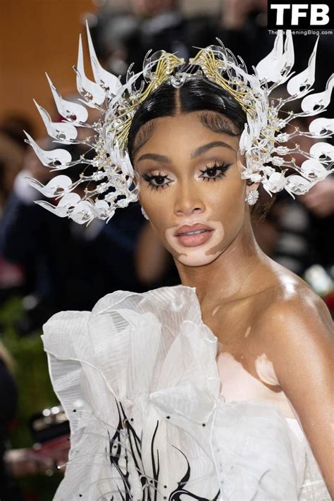 Winnie Harlow Legs 81 Photos The Fappening Stars