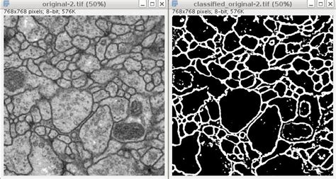 trainable segmentation plugin deprecated imagej