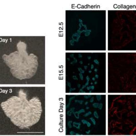Culture Of Pseudoglandular Stage Mouse Lung Extracted At E125 Shows