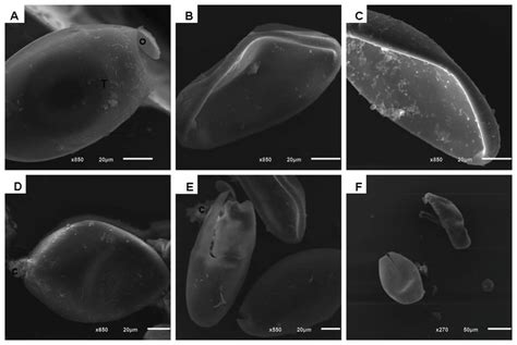 Scanning Electron Microscopy Of Fasciola Hepatica Eggs After 60 Minutes