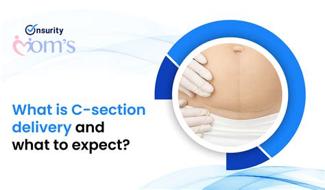 Explained All About C Section Delivery