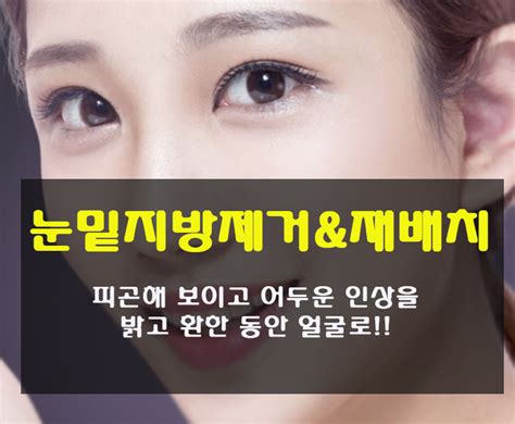 [눈밑성형]밝고 환한 동안 얼굴위한 눈밑지방재배치 제거 수술이란