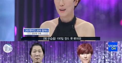 ‘렛미인 20대 할머니 ‘여신미모 수술비용 ‘1억 원 환골탈태