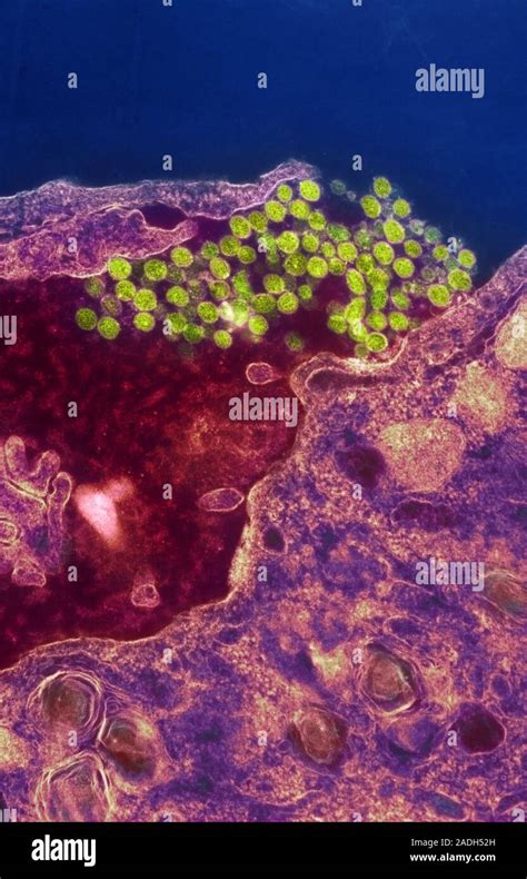 Hantavirus Infection Coloured Transmission Electron Micrograph Tem