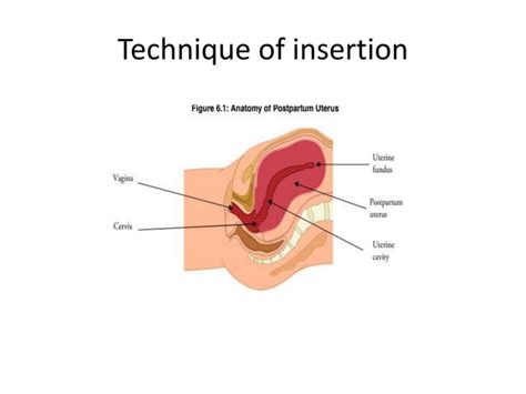 PPIUCD Programme Pptx