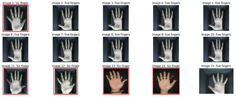 Advancements In Synthetic Generation Of Contactless Palmprint Biometrics Using Stylegan Models