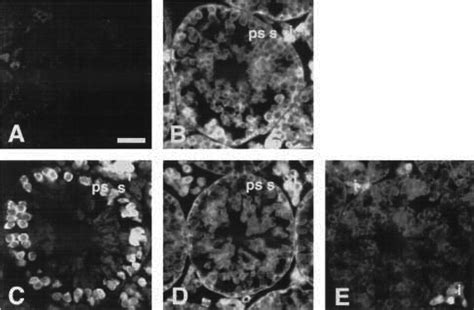 Expression Of Subunit And Subunit Subfamilies In The Testis Download Scientific Diagram