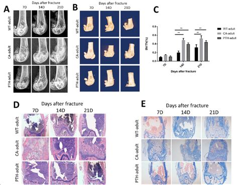 Defect Healing Of Femoral Metaphyseal Fractures In Adult Wild Type Download Scientific Diagram