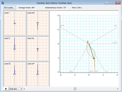 Cardiac Vector At Collection Of Cardiac Vector Free