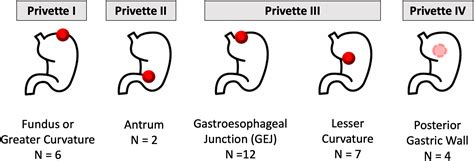 Robotic Function Preserving Resection Of Gastric Gastrointestinal Stromal Tumor Journal Of