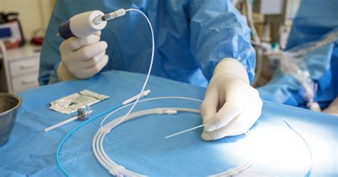 Av Graft For Dialysis Mckenzie Willamette Medical Center