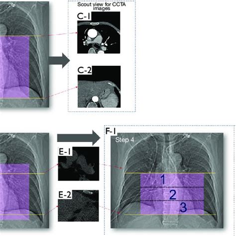 The Original Flowchart For Accurately Planning The Scan Range A Step Download Scientific