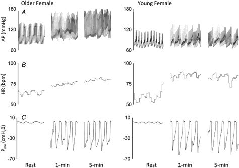 Effects Of Sex And Ageing On The Human Respiratory Muscle Metaboreflex