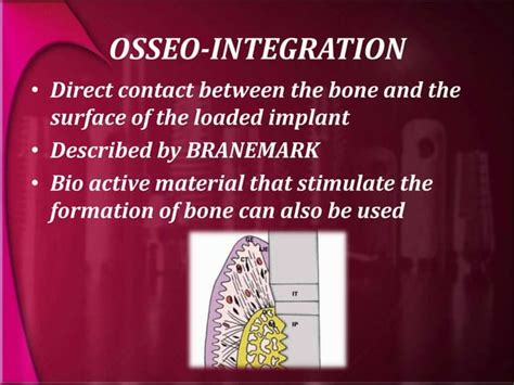 Types And Classification Of Dental Implants Pptx Operating Systems