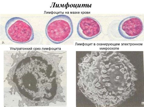Кровь, кроветворение, иммунный ответ - презентация онлайн