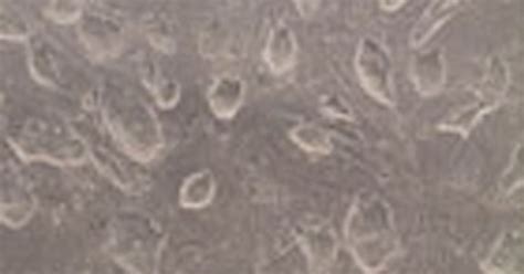 Mouse Embryonic Fibroblasts