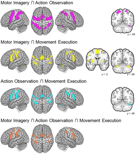 Conjunction Analyses Conducted Across Combinations Of The Tasks Note Download Scientific