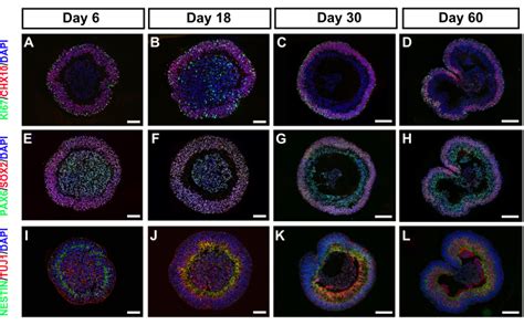 Generating Neural Retina From Human Pluripotent Stem Cells Protocol