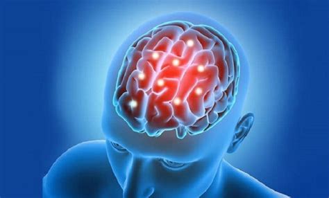 جراحی صرع و انواع آن کلینیک قاعده جمجمه و هیپوفیز ایران