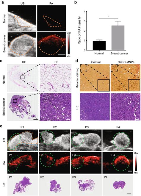 Workflow Of Crgd Mnps For Intraoperative Imaging Guided Surgery By