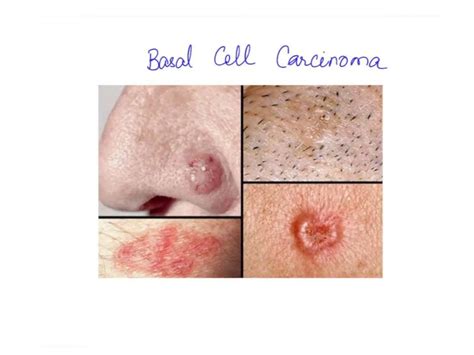 Anatomy And Histology Of Skindermis And Epidermispptx Skin And Dermatology Diseases And