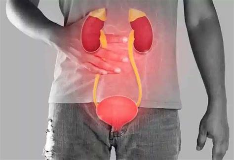 Urine Infection മതരതതൽ അണബധ മലമണ ഈ ലകഷണങങൾ പരഷനമരൽ പരതയകഷപപടനനത