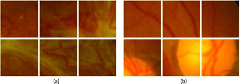 samples of cropped image patches used in the networks training a