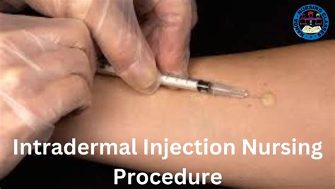 Intradermal Injection Procedure Nanda Nursing Classes