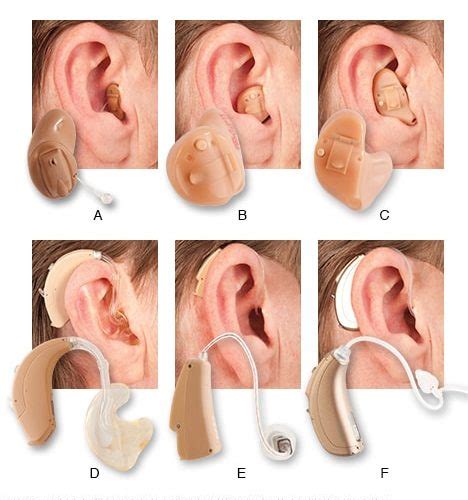 Gu A Completa Los Diferentes Tipos De Aud Fonos Para Personas Con Discapacidad Auditiva