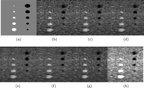 The Comparative Visual Assessment Of Diverse Filtering Techniques On