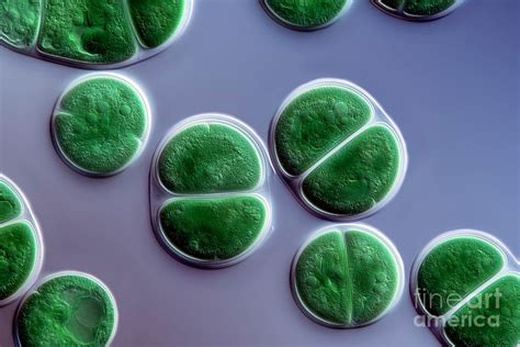 Chroococcus Turgidus Algae 3 By Science Photo Library
