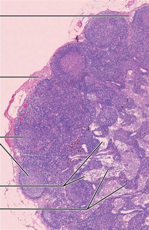 Lymph Node Slide Diagram Quizlet
