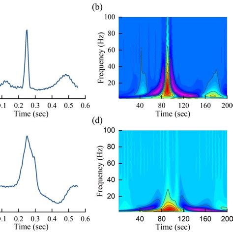Raw Ecg Heartbeat Signal And Cwt Scalogram Subfigures A B Represent