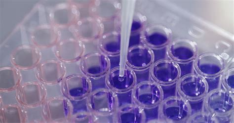 Stir Bar Sorptive Extraction Sbse And Headspace Sorptive Extraction Hsse An Overview