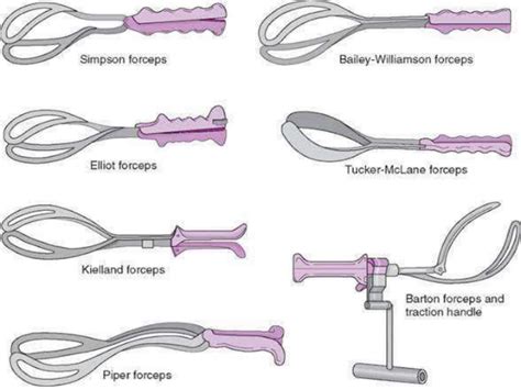 Forceps Delivery Pptx