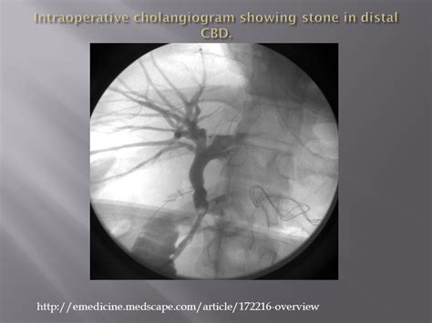 Ashley Esdaile Msiii Byron Baptist Msiii Mike Pothen Ms Iii Ppt Download