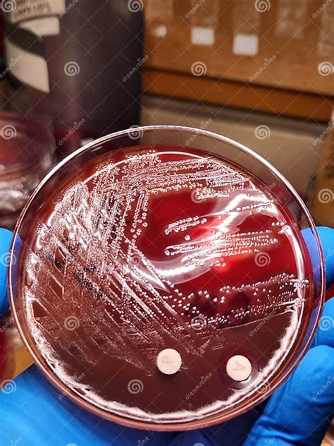 Group G Streptococcal Bacterial Colonies On Blood Agar Culture Plate