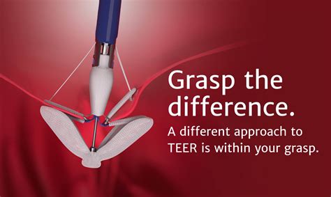 The Pascal Precision System Edwards Lifesciences