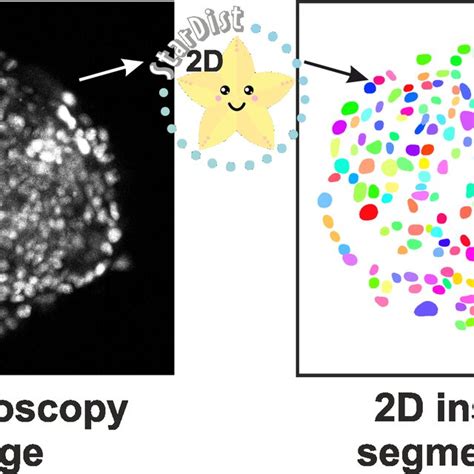 nuclei segmentation with the 2d db2018 pretrained stardist model